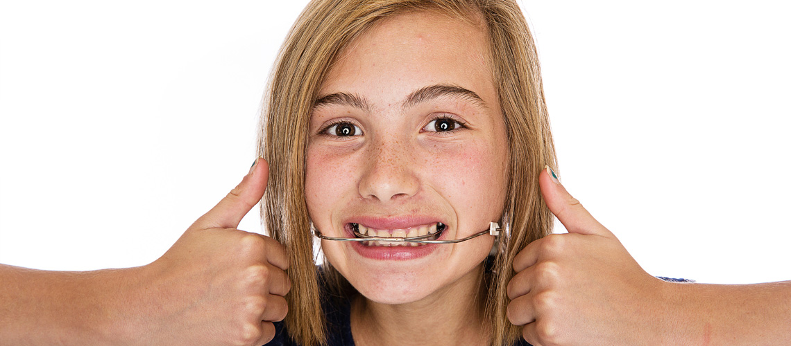 Instructions For Headgear | What To Expect | Serving Carlsbad, Vista ...